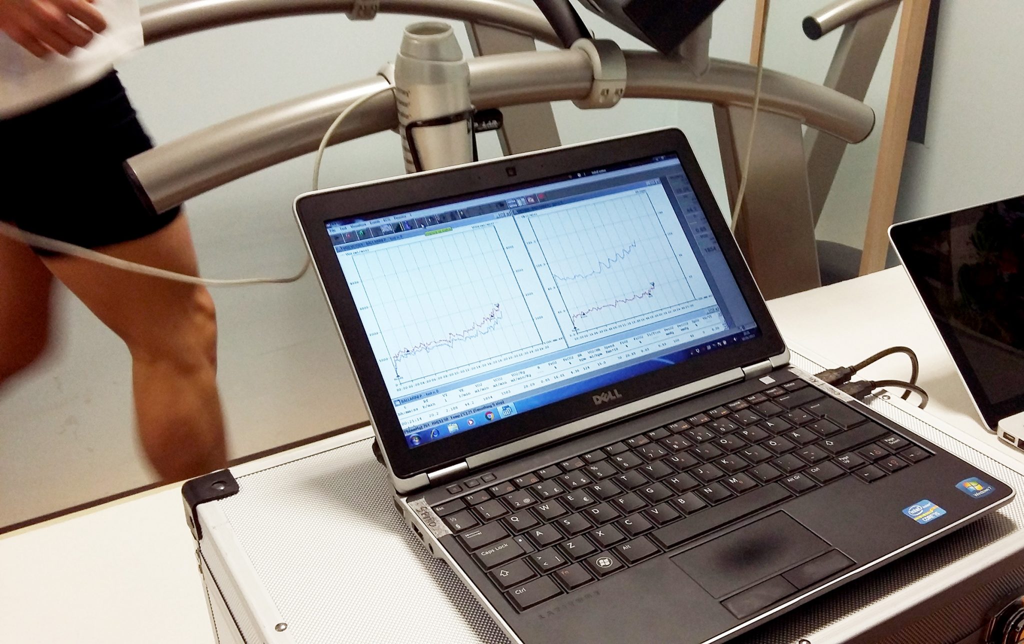 Anteprima esclusiva: il test Cozzini-Vincenzi - ENDU channel